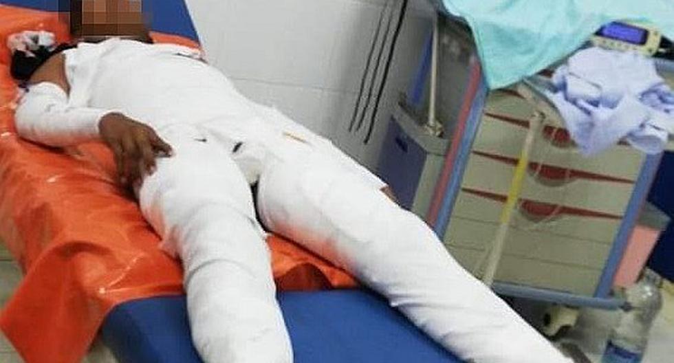 Menor lucha por vivir con el 70% del cuerpo quemado | EDICION | CORREO