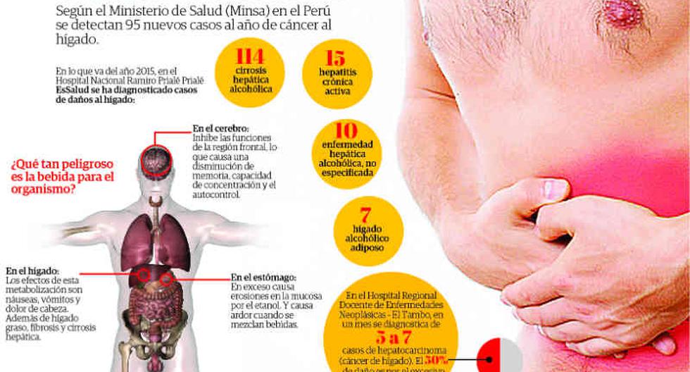 163 pacientes con cirrosis hepática en EsSalud | EDICION | CORREO