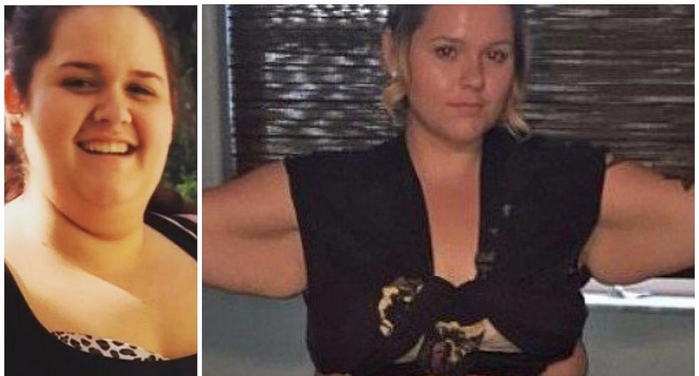 Impactante transformación de mujer que perdió 79 kilos y pudo lucir ...