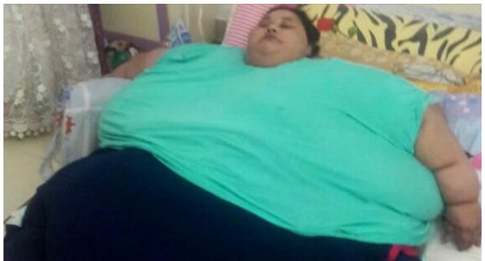 India: la mujer más obesa del mundo perdió 100 kilos tras ser operada ...