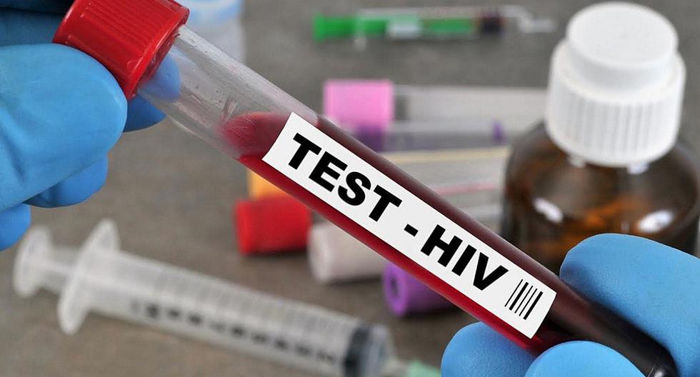 Sida: conoce diez mitos y verdades de esta enfermedad | SALUD | CORREO