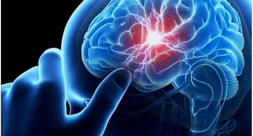 Epilepsia: Desarrollan un estimulador eléctrico cerebral como ...