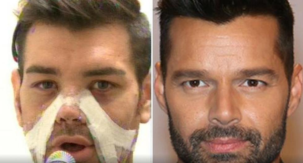 Hombre se somete a una docena de cirugías para parecerse a Ricky Martin ...