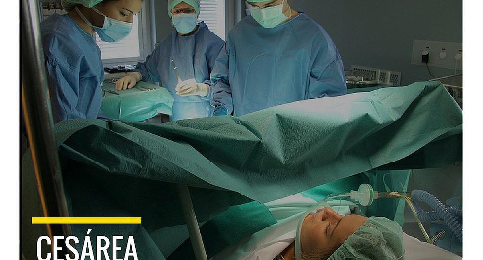 Tres aspectos sobre las cesáreas que se pasan por alto | SALUD | CORREO