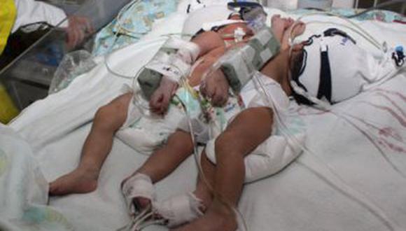 Siamesas fallecen asfixiadas | PERU | CORREO